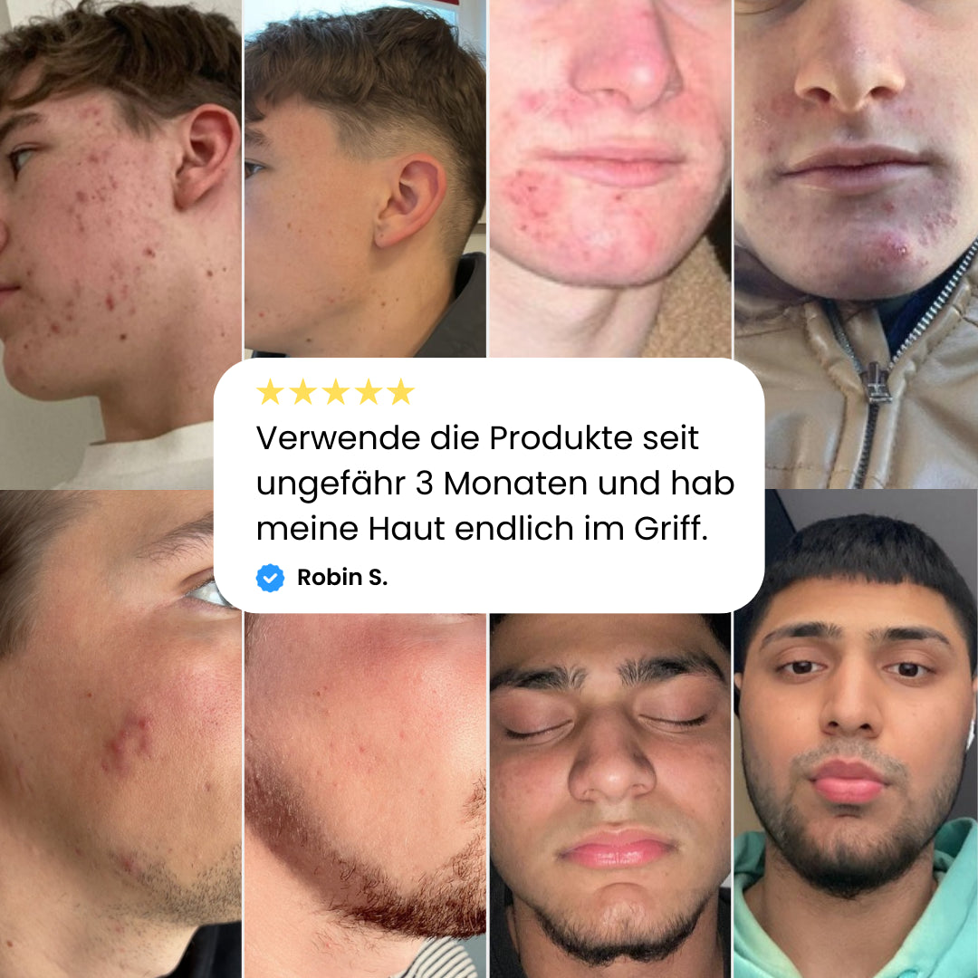 NOUMEN Skin Supplement I Für gesunde Männerhaut